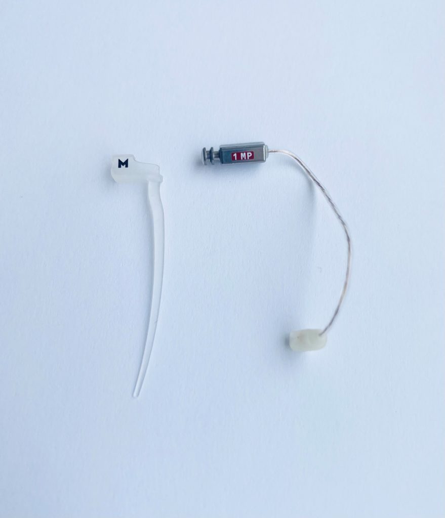 GN ReSound Hearing Aid Sports Locks (10pack) - for SureFit 2 Receiver ...